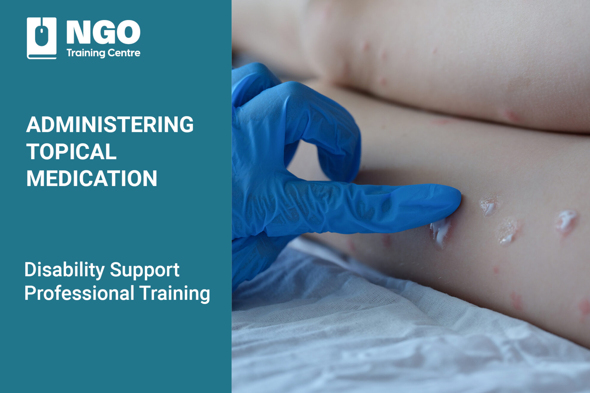 Topical Medication Administration | Caregiver Training