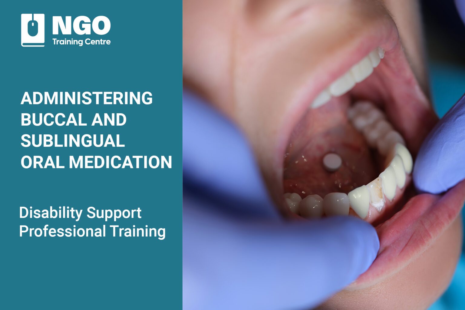 Administering Buccal and Sublingual Medication | NGO Training Centre